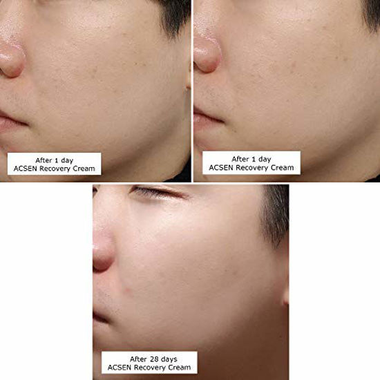 GetUSCart- TROIAREUKE ACSEN Recovery Cream 0.84 fl. oz. | Hydrating and ...