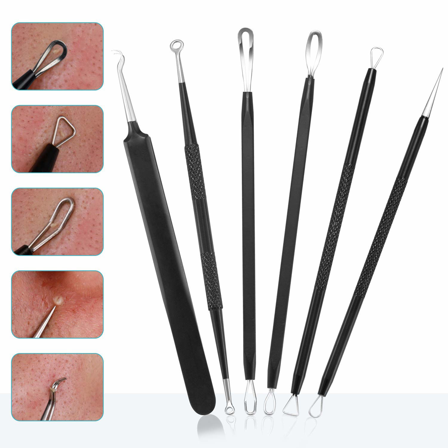 GetUSCart- Blackhead Remover Pimple Popper Tool Kit - (6 Piece Kit ...
