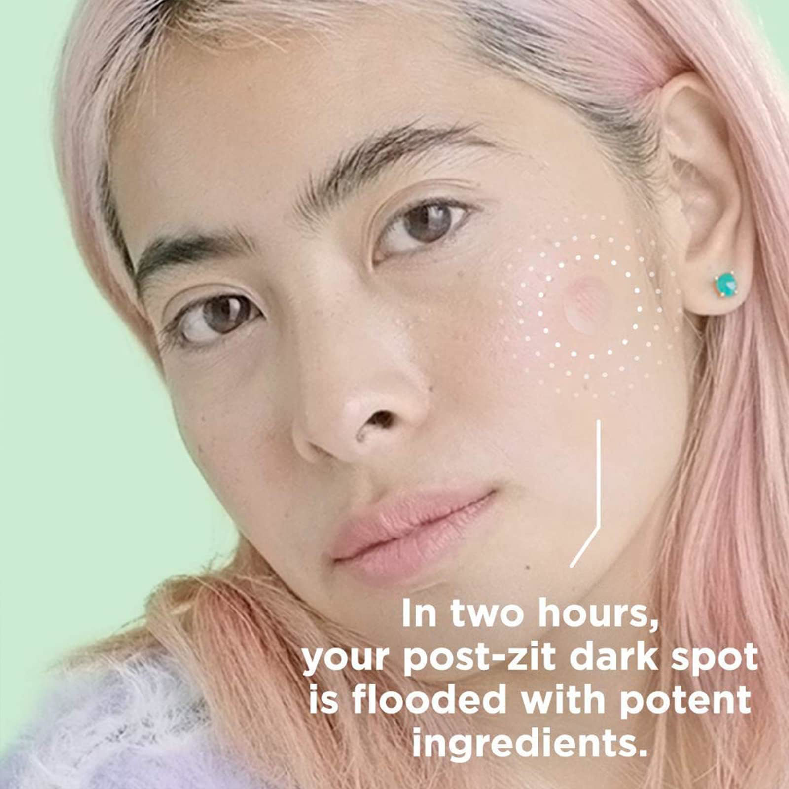 GetUSCart- ZitSticka Hyperfade Acne Patches for Face - World's Most ...