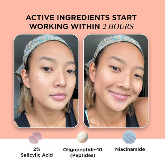 GetUSCart- ZitSticka Extra Strength Killa Acne Patches for Face - World ...