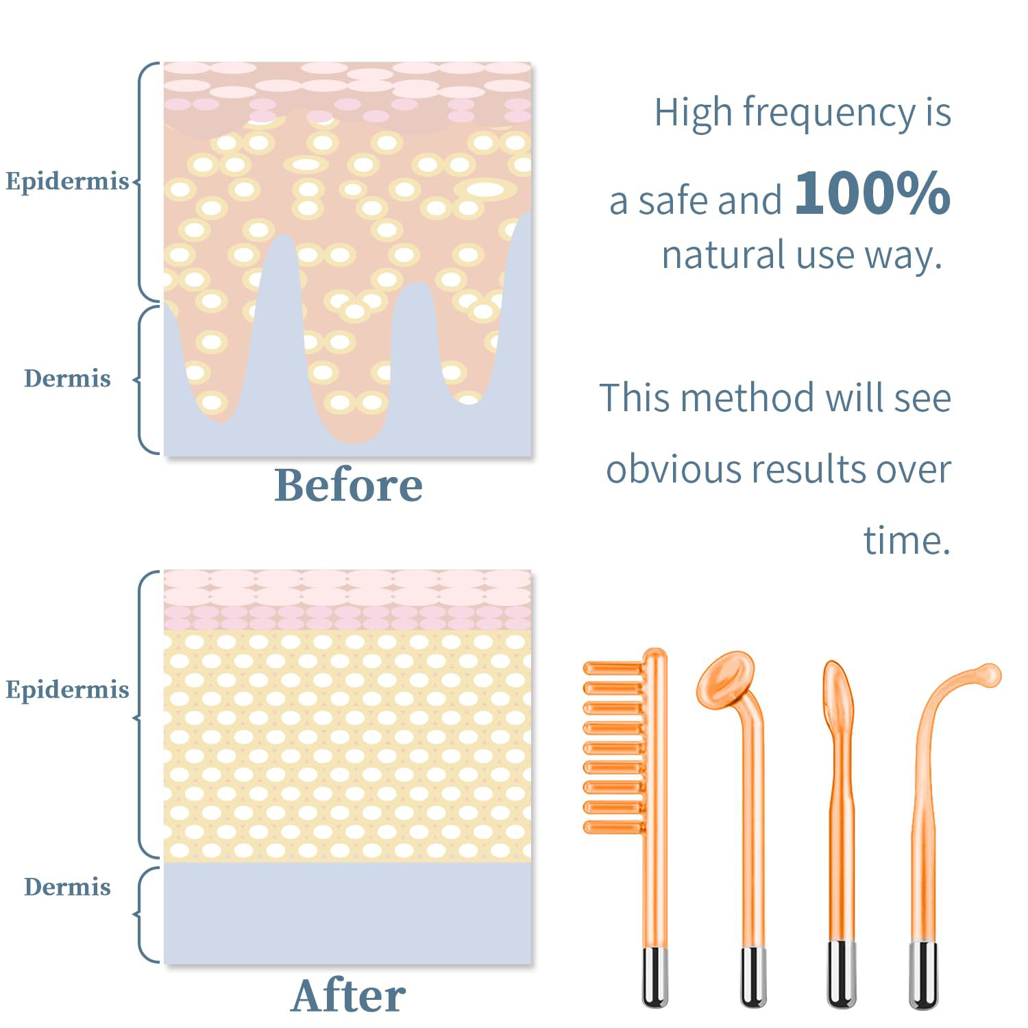 GetUSCart- High Frequency Facial Machine - TUMAKOU Portable Handheld ...