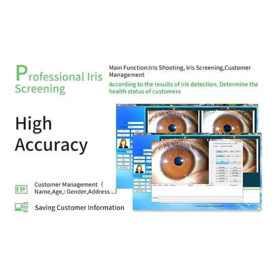 GetUSCart- Multi-Function Iris Analyzer Iridology Camera, Usb Computer ...