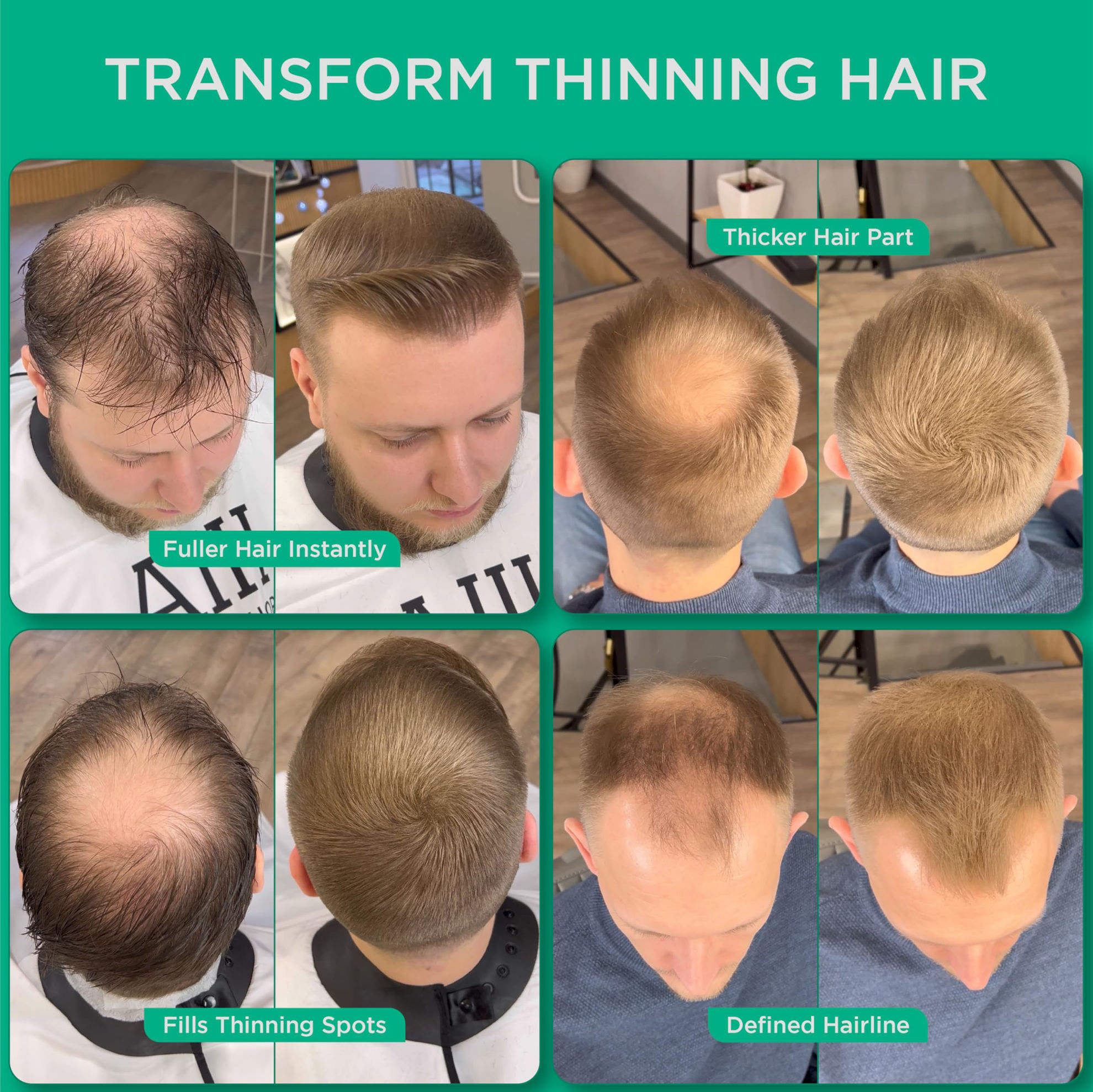 GetUSCart- THICK FIBER Hair Building Fibers for Bald Spots & Thinning ...
