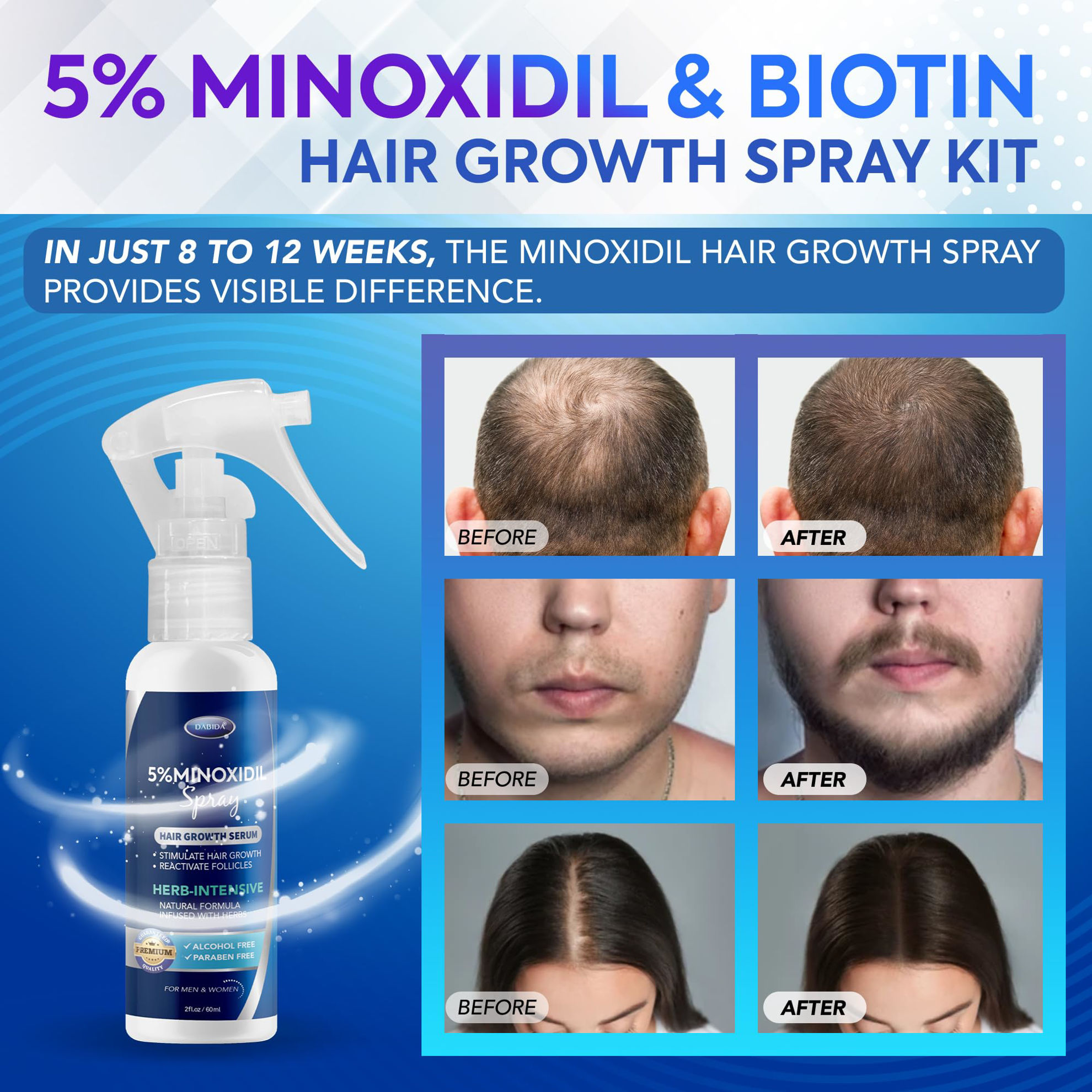 GetUSCart- Minoxidil 5 Percent, Minoxidil for Men Spray Kit, Minoxidil ...