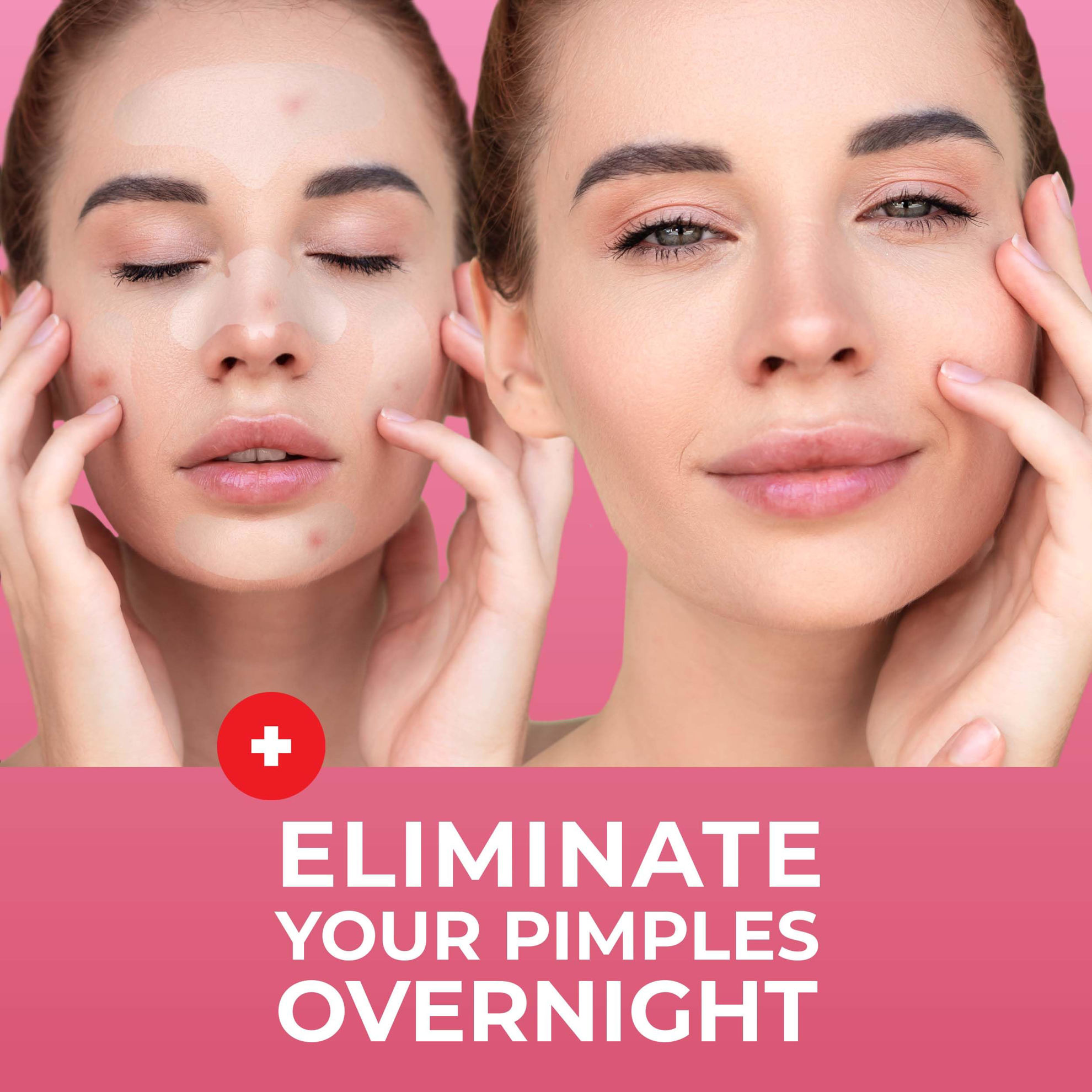 GetUSCart- PatchRx Full Face Pimple Patches (5 Sets), Reduce Pimples On ...