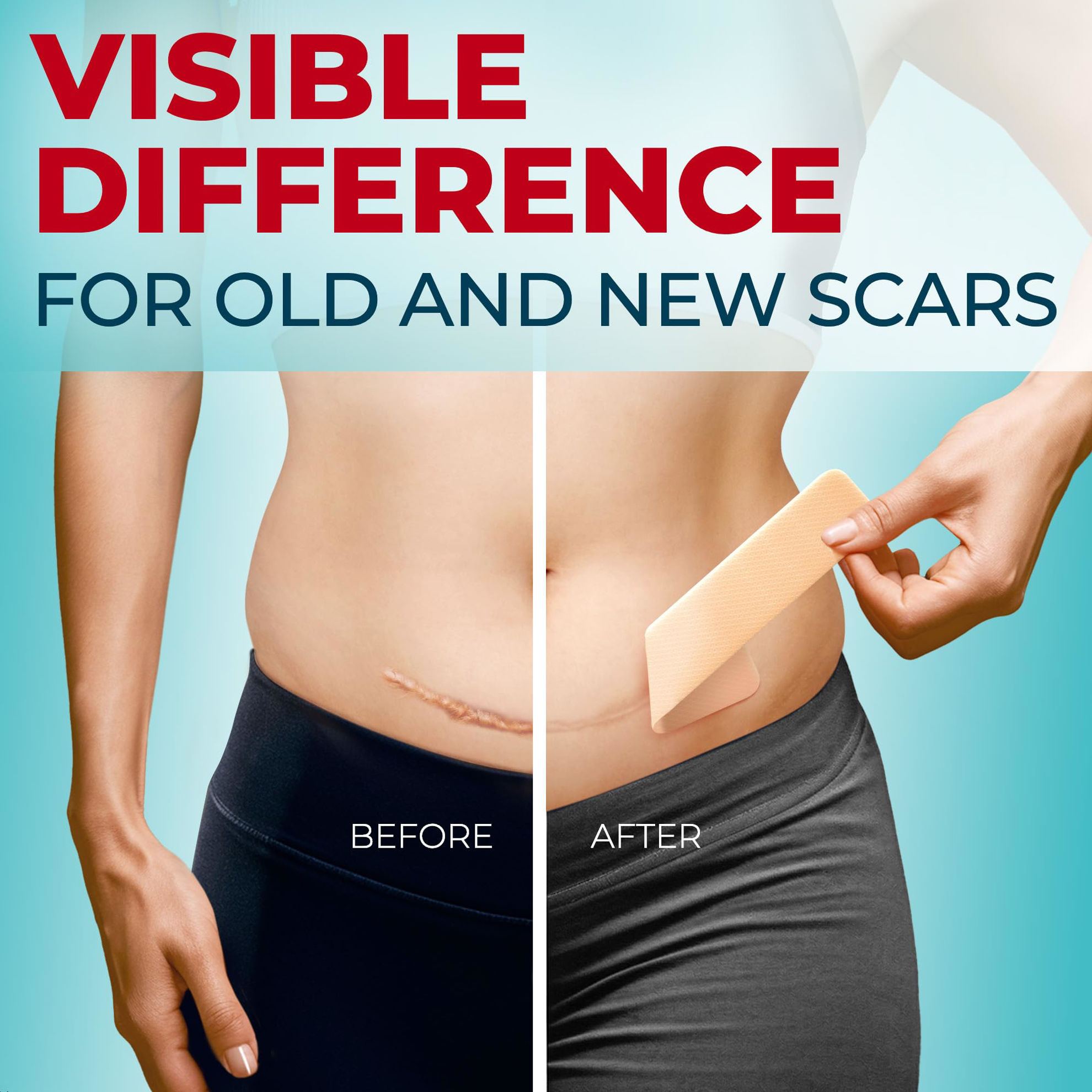 GetUSCart- Medical Grade Silicone Scar Tape - 1.6”x120” - Visible ...