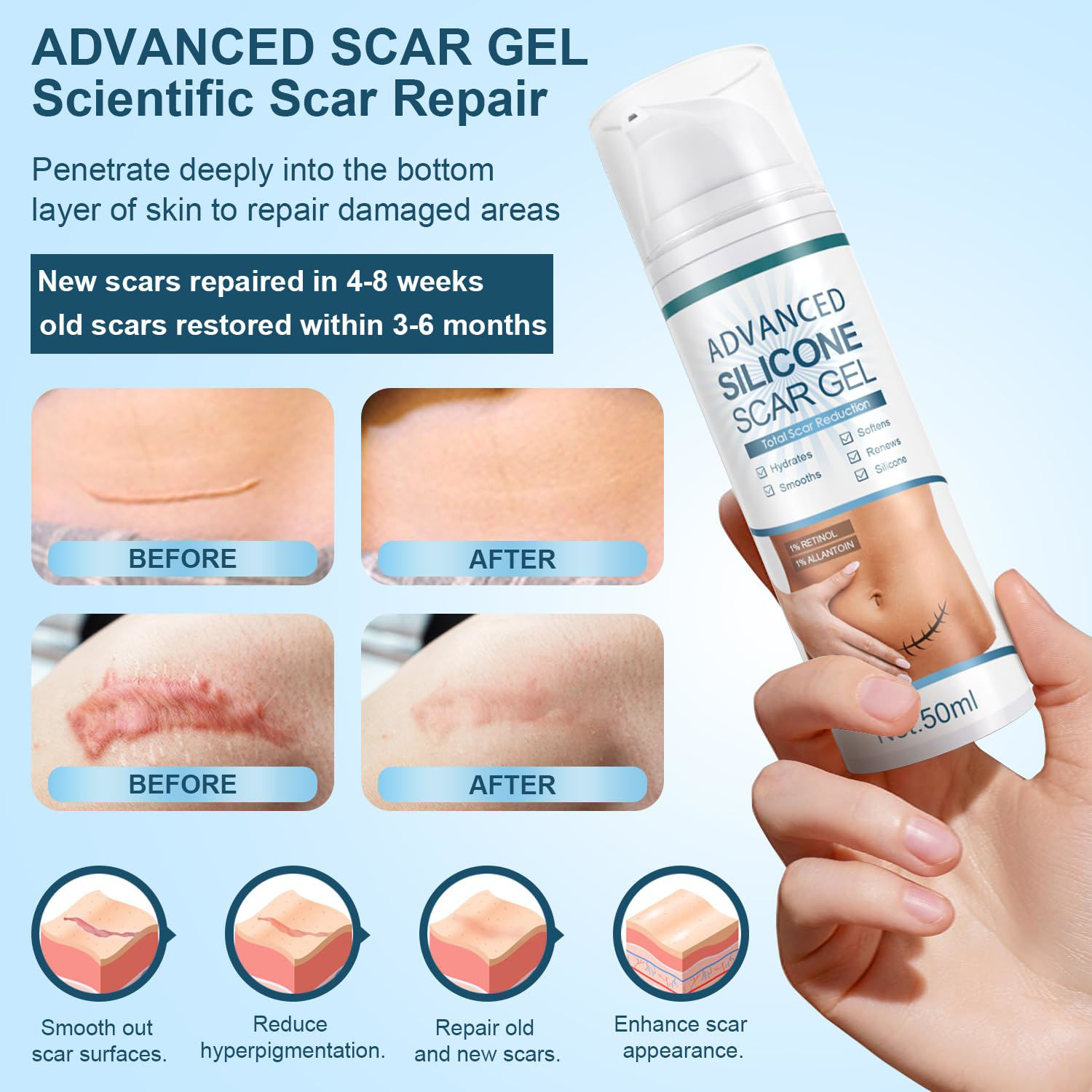 GetUSCart- Advanced Scar Cream, Silicone Scar Gel, Treats Old and New ...