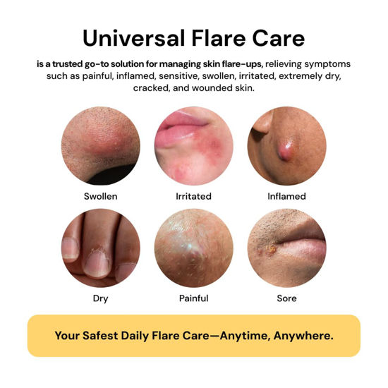 GetUSCart- Universal Flare Care | Relief for 97% of Common Skin Issues ...