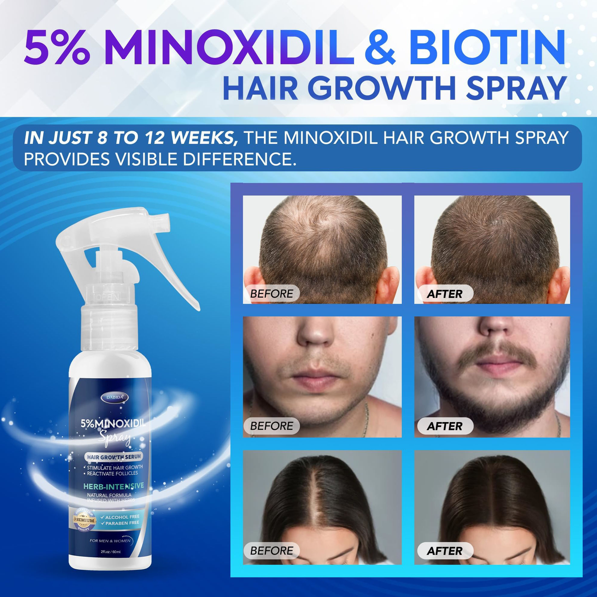 GetUSCart- 5% Minoxidil for Men Hair, Minoxidil Spray, Minoxidil for ...