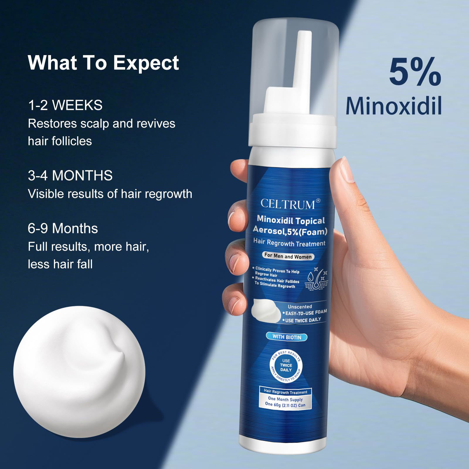 GetUSCart- Minoxidil Foam, 5% Topical Minoxidil Foam, Minoxidil for Men ...