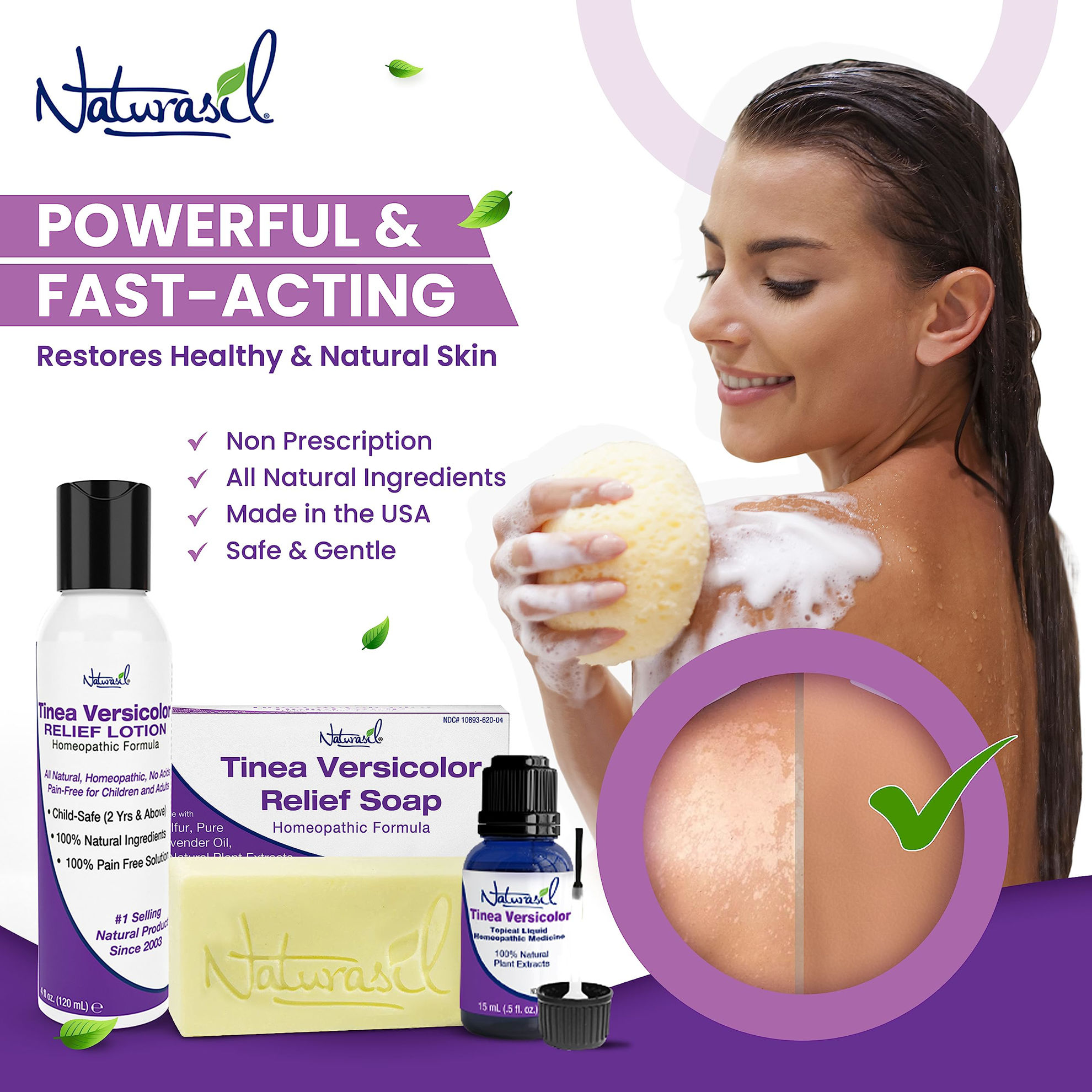 GetUSCart- Naturasil Tinea Versicolor Treatment Max-Strength 10x Soap ...