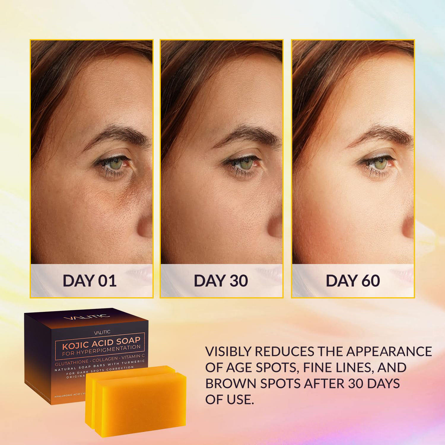 GetUSCart- VALITIC Kojic Acid Soap for Hyperpigmentation - with ...