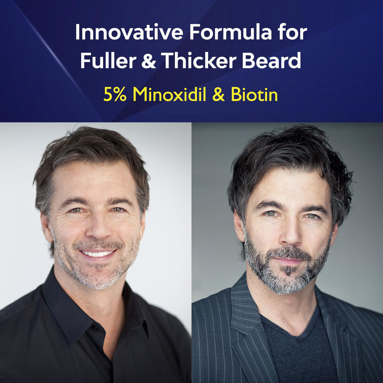 GetUSCart- 5% Minoxidil for Men, Minoxidil Beard Growth Kit, Minoxidil ...